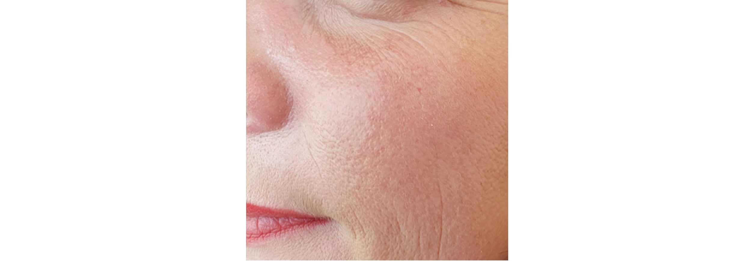 RED LED+ Anti-Aging Light Therapy