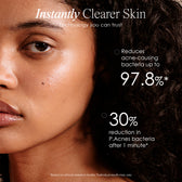 Faisca Neon & Argon | High Frequency Wand | Project E Beauty